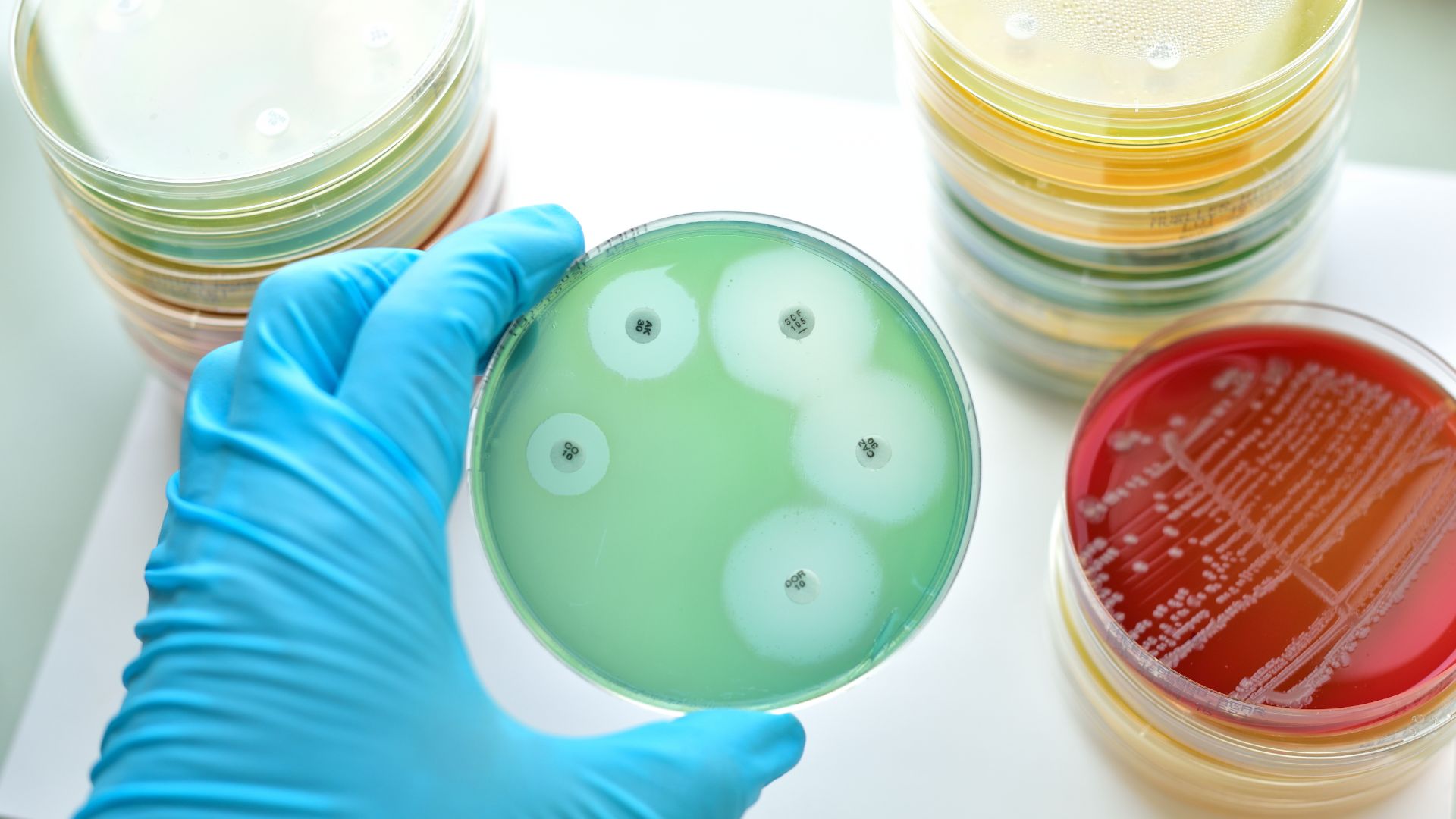 ¿Qué técnicas o métodos existen para identificar a las bacterias ...