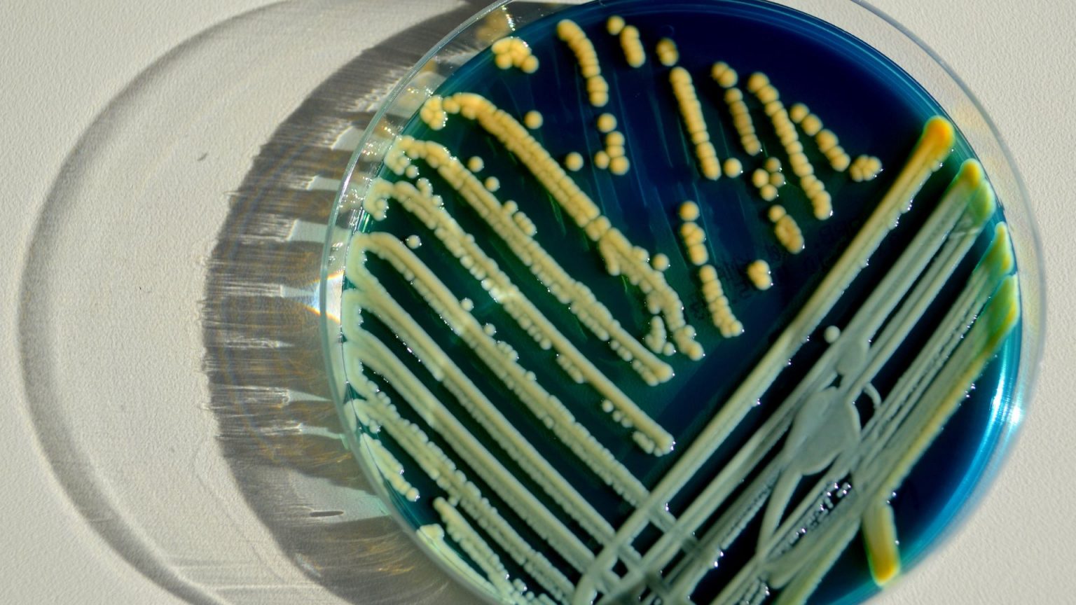 ¿Qué técnicas o métodos existen para identificar a las bacterias ...