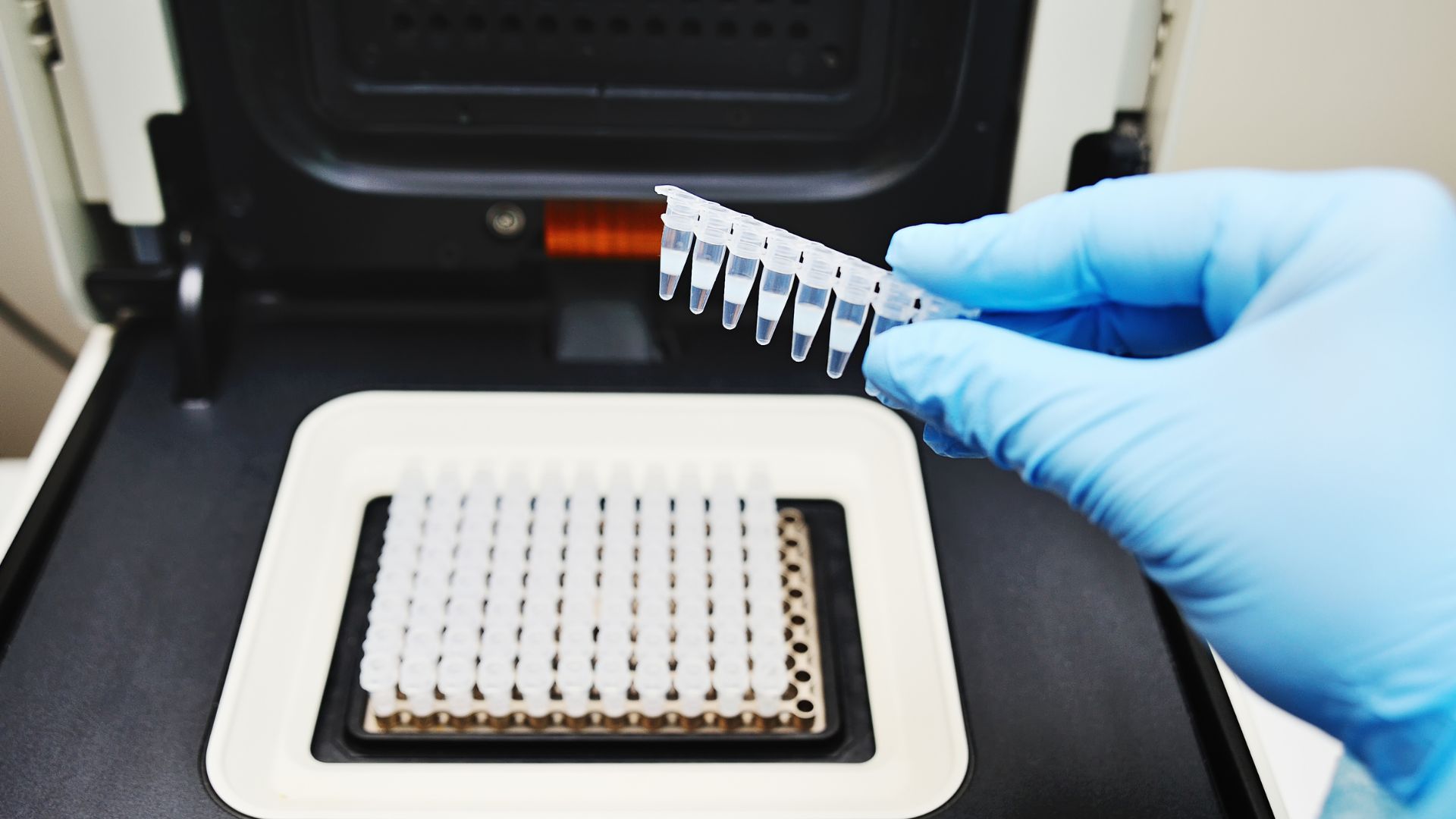 ¿Qué técnicas o métodos existen para identificar a las bacterias ...