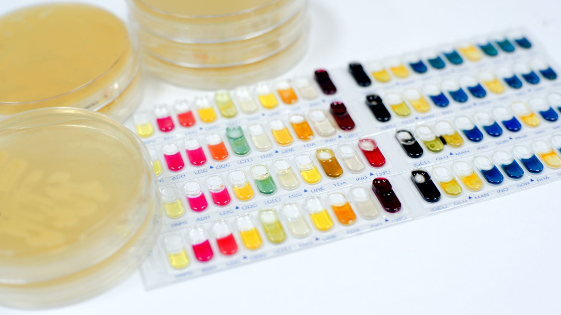 ¿Qué técnicas o métodos existen para identificar a las bacterias? - Microbioma Lab